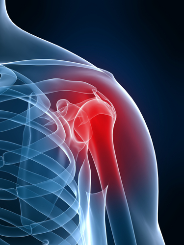 Shoulder Physical Therapy | BreakThrough Physical Therapy Sunnyvale